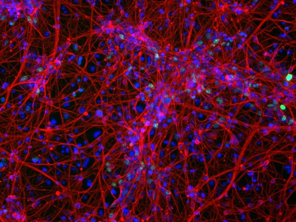 Hamilton Robotics | Cell-Based High-Throughput Screening