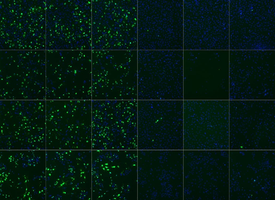Hamilton Robotics | Cell-Based High-Throughput Screening
